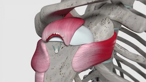 Shoulder Surgery With One Anchor Suture... | Stock Video | Pond5