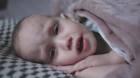 sick baby toddler child suffering from c... | Stock Video | Pond5