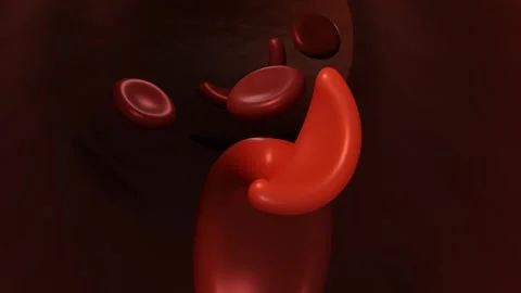 sickle cells anemia are flowing inside o... | Stock Video | Pond5