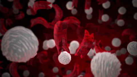 Sickle cells with white cells medical co... | Stock Video | Pond5