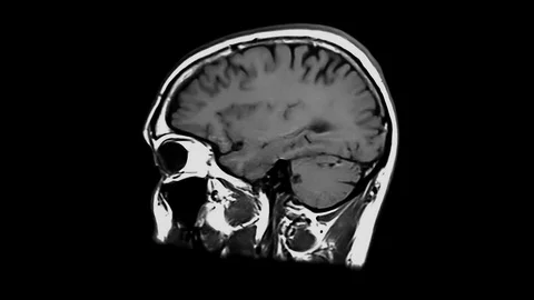 Side Profile MRI Brain Scan 4K | Stock Video | Pond5