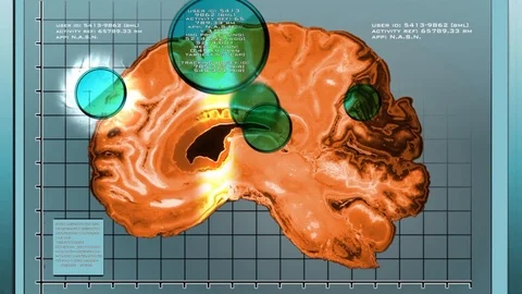 Side view cross section of a brain MRI o... | Stock Video | Pond5