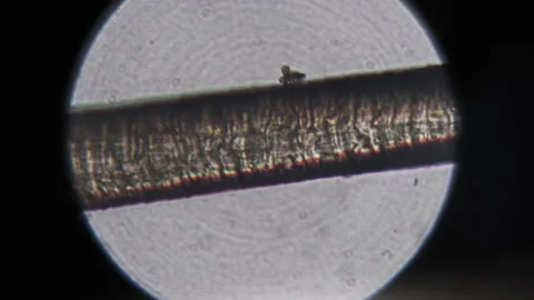 Single Human Hair Under a Microscope Mag... | Stock Video | Pond5