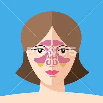Sinusitis disease, vector nose illustration, sinus anatomy, human ...