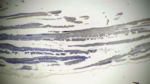 Skeletal muscle in longitudinal section ... | Stock Video | Pond5