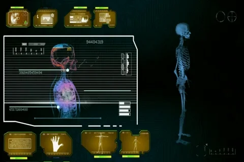 Skeleton - Monitor Analysis in System - ... | Stock Video | Pond5