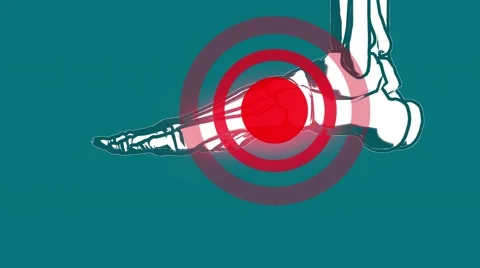 Foot Pain 3D Stock Videos – Royalty-Free HD & 4K Videos