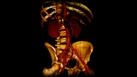 Skeleton scanning In 3D Mri scan. CT Sca... | Stock Video | Pond5