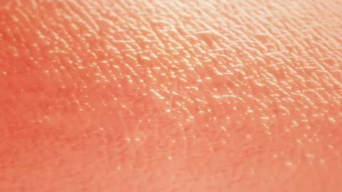 Skin imperfection healing. Skin scratch,... | Stock Video | Pond5