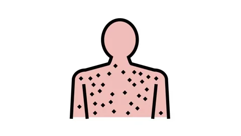 skin rash disease color icon animation | Stock Video | Pond5