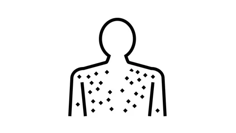 skin rash disease line icon animation | Stock Video | Pond5