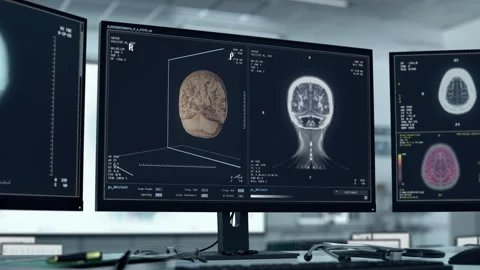 Skull X-Ray Scan Using Biotechnology Ana... | Stock Video | Pond5