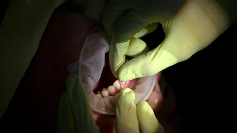 Slow motion vertical shot of a dentist w... | Stock Video | Pond5