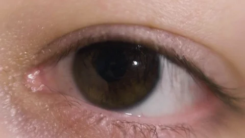 Eye Wobbling Wobbling Stock Footage ~ Royalty Free Stock Videos | Pond5