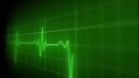 Slowmotion concept animation of an ECG ,... | Stock Video | Pond5