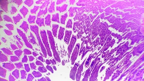 Small human intestine in cross section f... | Stock Video | Pond5