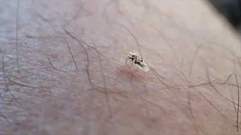Small insect creeps on human skin | Stock Video | Pond5