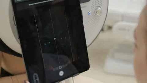Smart AI Digital Skin Analysis Facial I... | Stock Video | Pond5