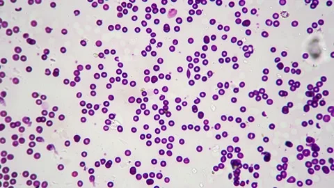 Human Blood Smear Under Microscope