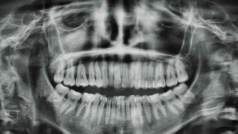 Smiling x-ray jaw. | Stock Video | Pond5