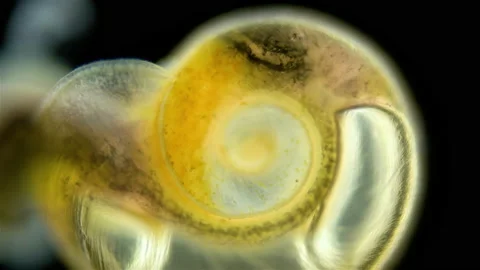 Snail Family Planorbidae under microscop... | Stock Video | Pond5