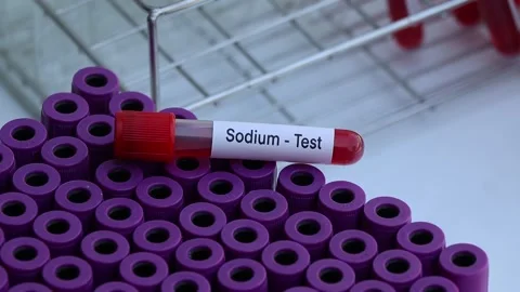 Sodium test to look for abnormalities fr... | Stock Video | Pond5