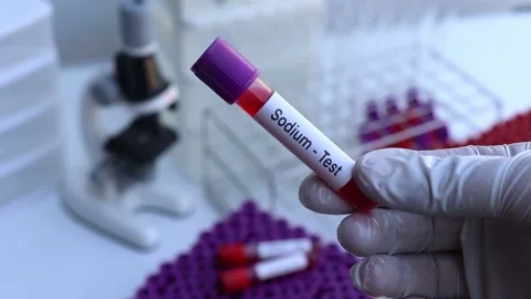 Sodium test to look for abnormalities fr... | Stock Video | Pond5