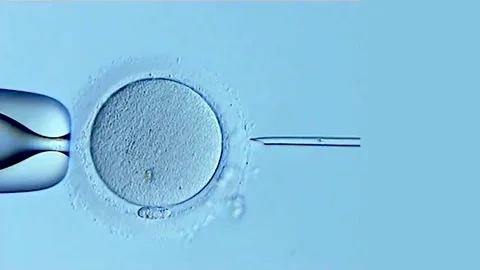 Sperm injection. Microscope lens in vitr... | Stock Video | Pond5