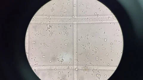 Sperm Motility Stock Video Footage | Royalty Free Sperm Motility Videos ...