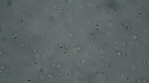 Sperm under the microscope, the movement... | Stock Video | Pond5