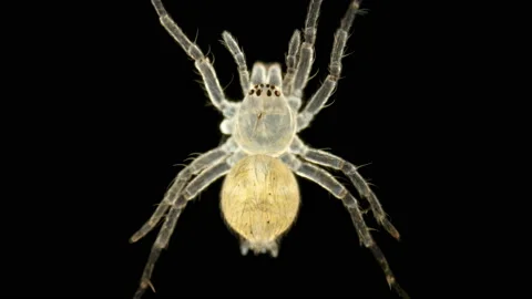 spider under a microscope, Arachnida cla... | Stock Video | Pond5