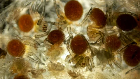 Spider under a microscope, Arachnida cla... | Stock Video | Pond5