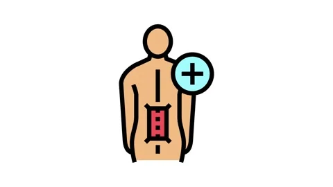 spinal surgery color icon animation | Stock Video | Pond5