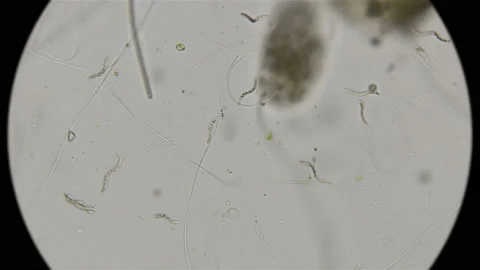 spiral, curved bacterium, a parasite ,un... | Stock Video | Pond5