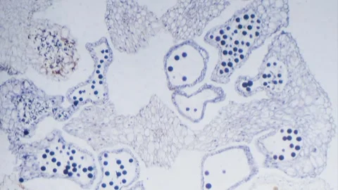 Stained stem of monocotyledon transverse... | Stock Video | Pond5