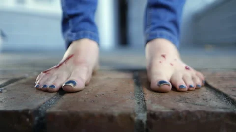 Static shot of blood dripping on a woman... | Stock Video | Pond5