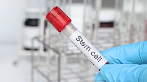 Stem cell test to look for abnormalities... | Stock Video | Pond5