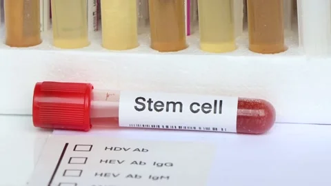 Stem cell test to look for abnormalities... | Stock Video | Pond5