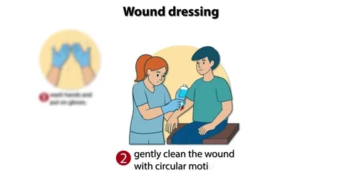 Step-by-Step Guide to Proper Wound Dress... | Stock Video | Pond5