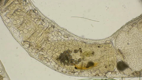 the stomach of an intestinal worm oligoc... | Stock Video | Pond5