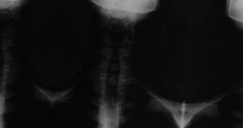 Stop motion animated X-ray texture backg... | Stock Video | Pond5