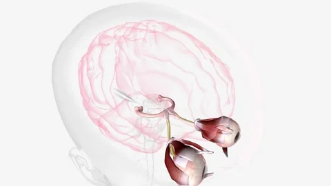 Strabismic Amblyopia Visual Pathway with... | Stock Video | Pond5