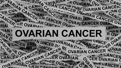 Ovarian Cancer Stock Video Footage | Royalty Free Ovarian Cancer Videos ...