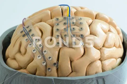 Subdural grid electrode for brain waves recording on the brain model Stock Photo #172421905