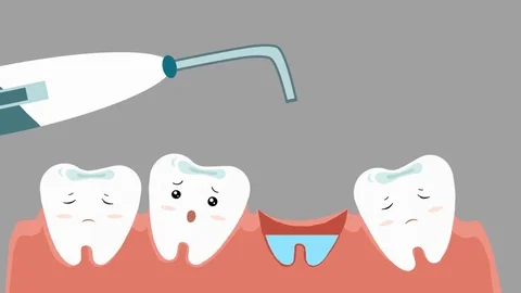Suction - Dental Care - Vector Animation... | Stock Video | Pond5