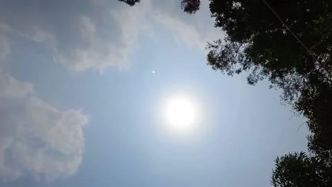 Sunny Day. Time Lapse Of Clouds Moving T... | Stock Video | Pond5