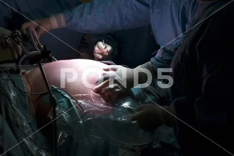 Surgery, coelioscopy Hospital. Visceral and digestive surgery. Surgery ...