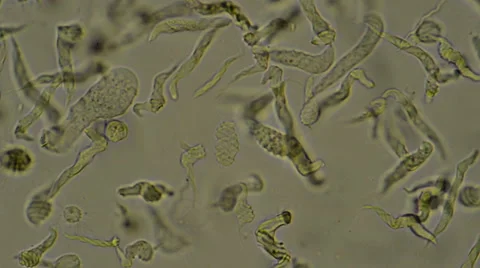 Symbiont protozoa from termite gut | Stock Video | Pond5