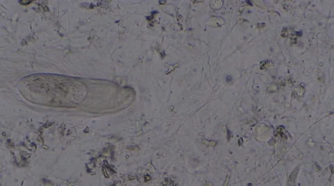 Protozoa Stock Footage ~ Royalty Free Stock Videos | Pond5