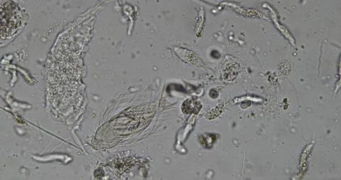 Symbiotic protozoa in termite gut | Stock Video | Pond5